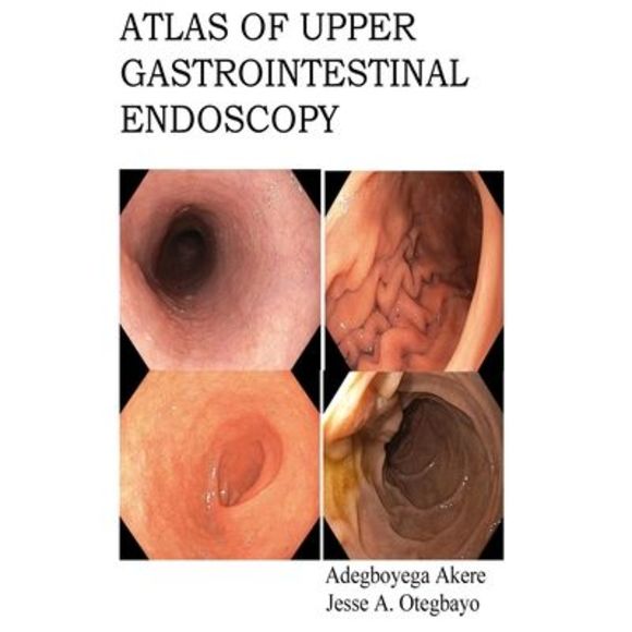 Jesse Abiodun Otegbayo | Other | Atlas Of Upper Gastrointestinal ...